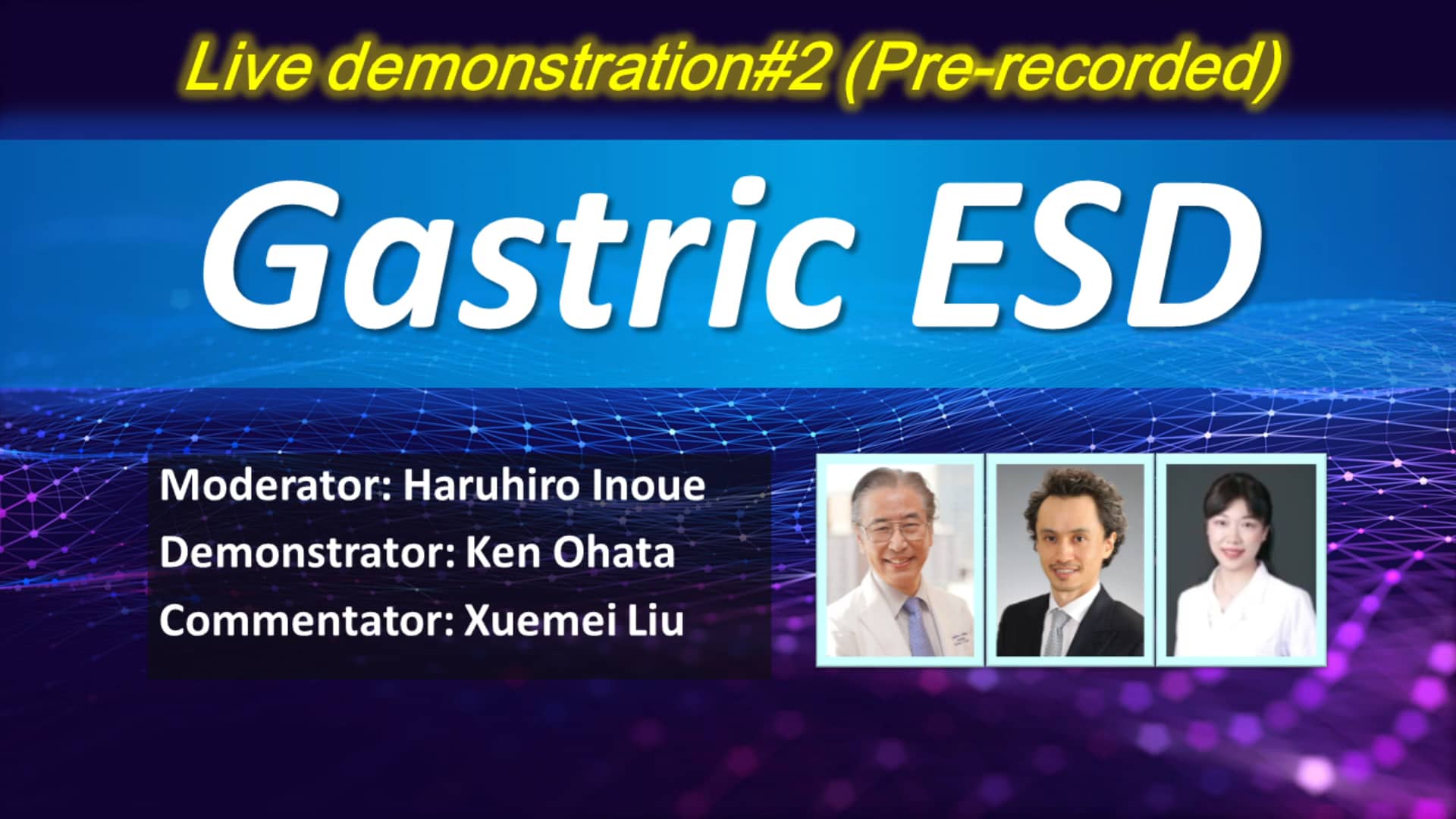 Gastric ESD by Dr.Ken Ohata on Vimeo