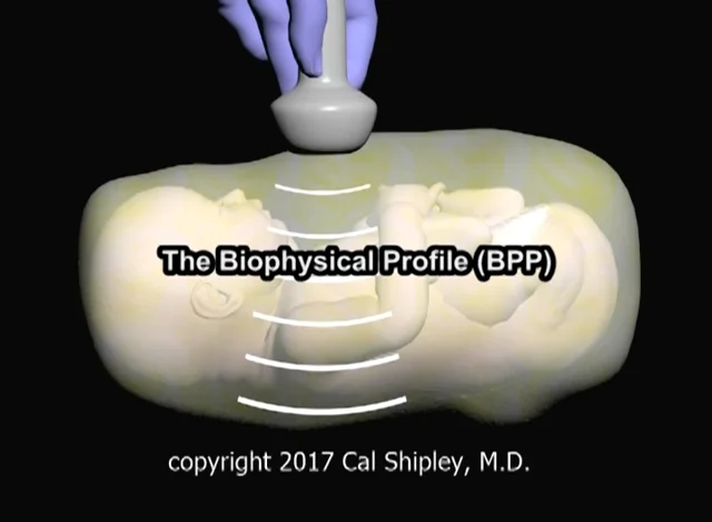 Biophysical Profile