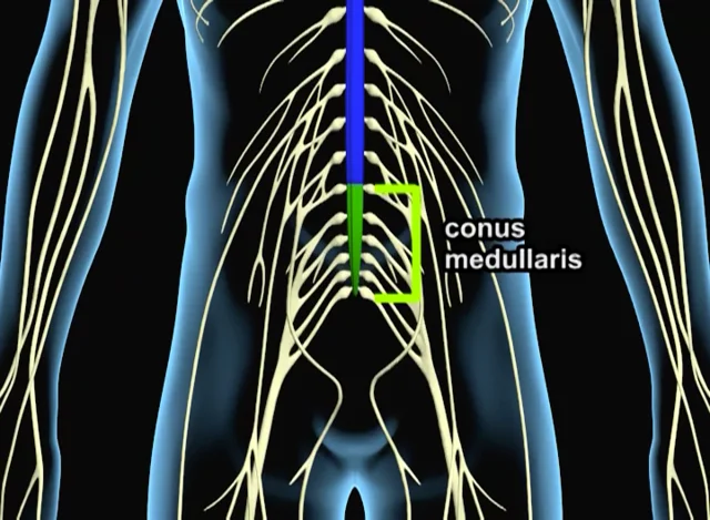 Spinal Cord Cauda Equina Conus Medullaris