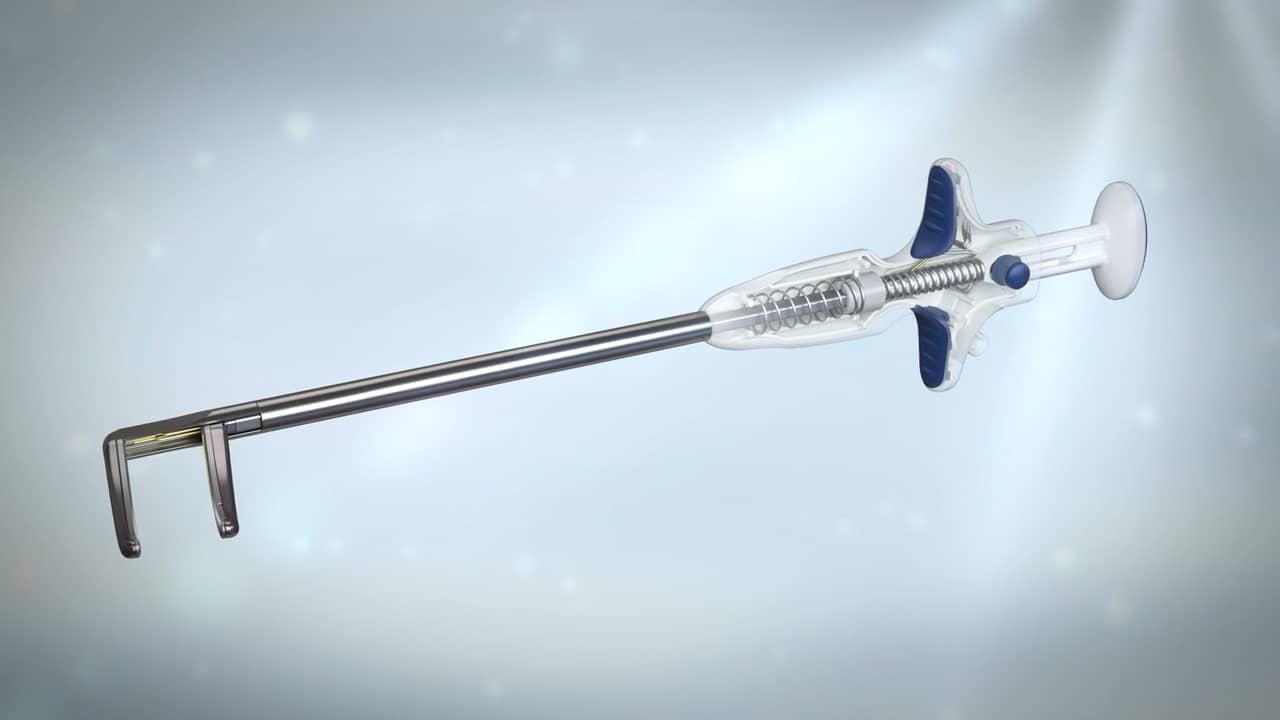 Isolator® Synergy™ Clamp Animation (OLL2/OSL2) on Vimeo