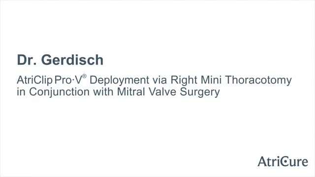 Deploying the AtriClip PRO∙V™ Device - Dr. Gerdisch on Vimeo
