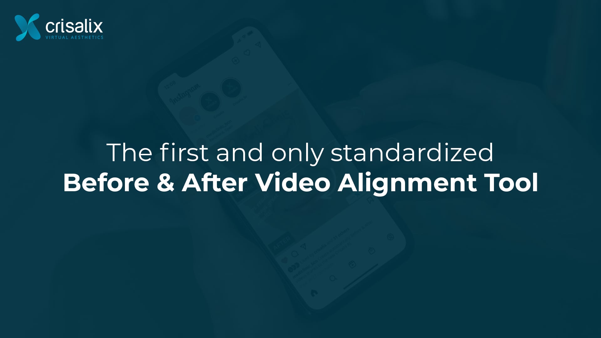 The first and only standardized Before & After Video Alignment Tool