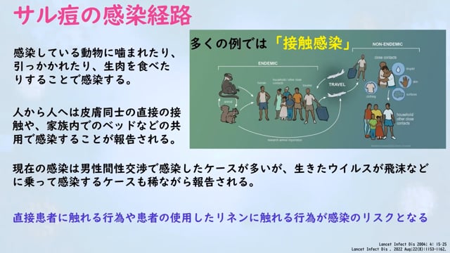 武藤義和先生の感染症ワンポイントレッスン(12)：インフルエンザ～君、最近みてないよね | MEDI-LIB メディライブ - 医療従事者向けセミナー動画配信サイト-