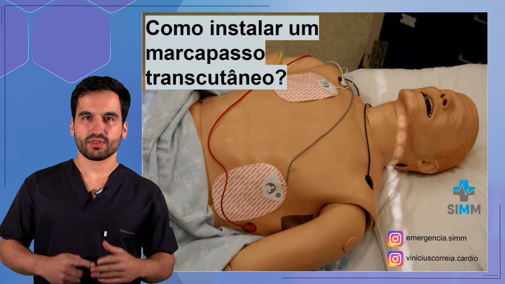 Como instalar um marcapasso transcutâneo on Vimeo