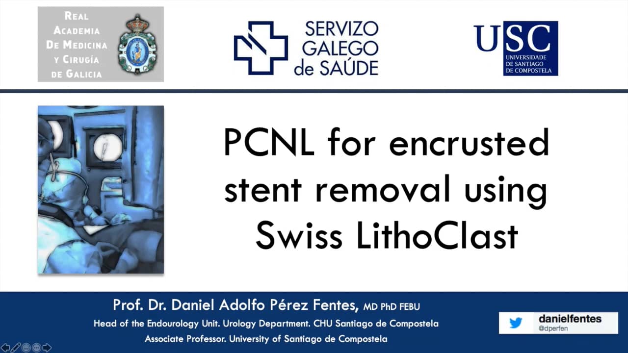 Case_46_PCNL_To_Remove_Encrusted Stent_Prof_Dr_Daniel Adolfo Perez ...