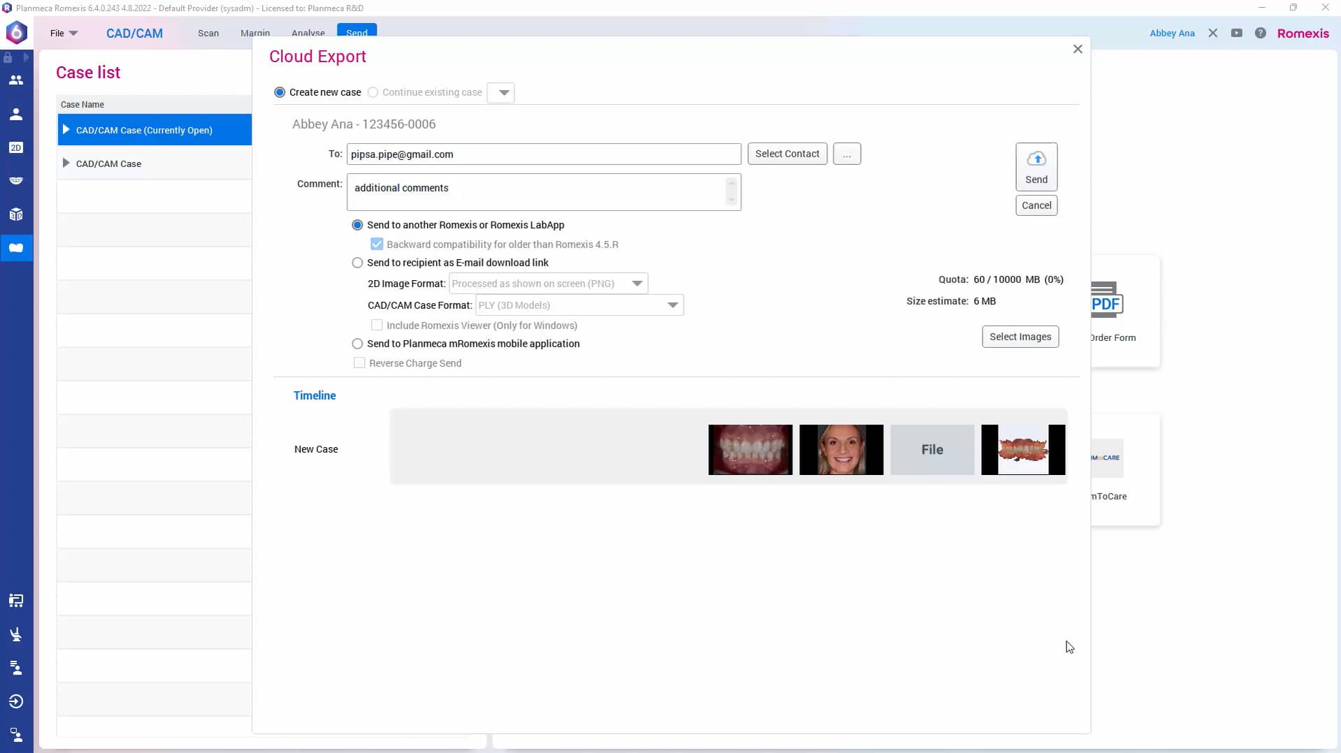 How to - Send scans using Romexis Cloud on Vimeo