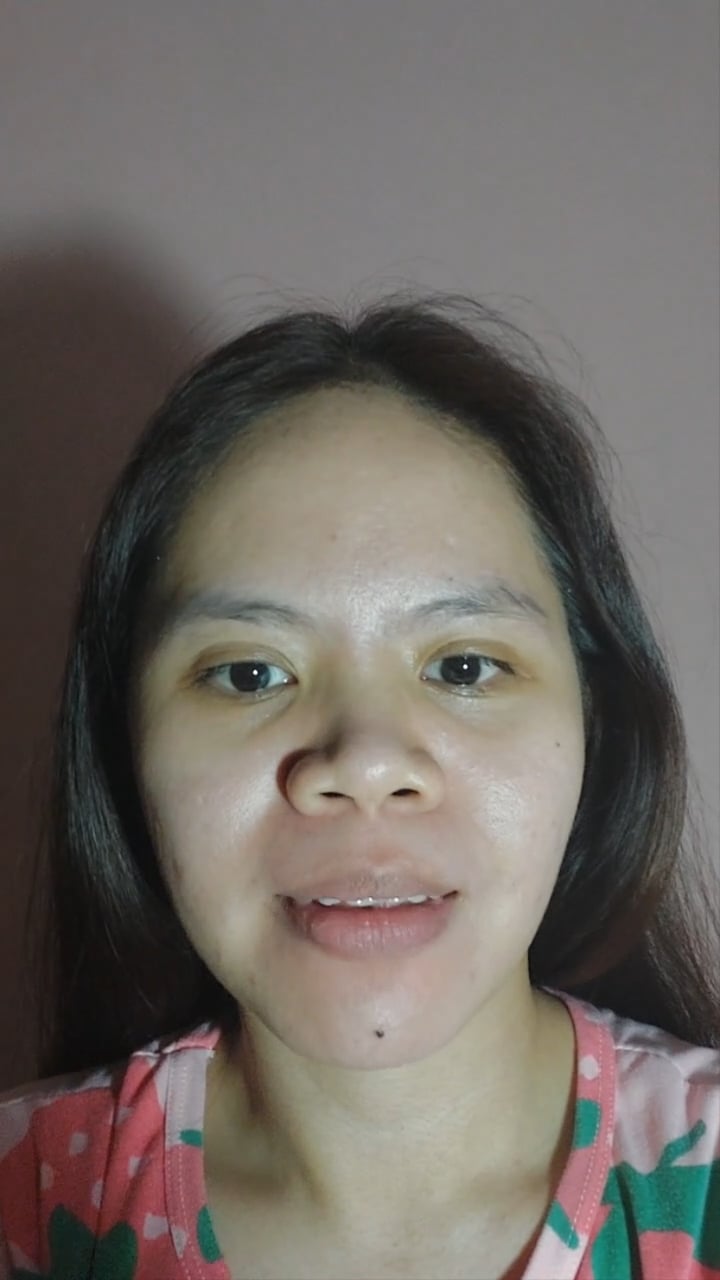Product 25558 - Garnier Anti-Acne Serum by nadene-joy.porras on Vimeo