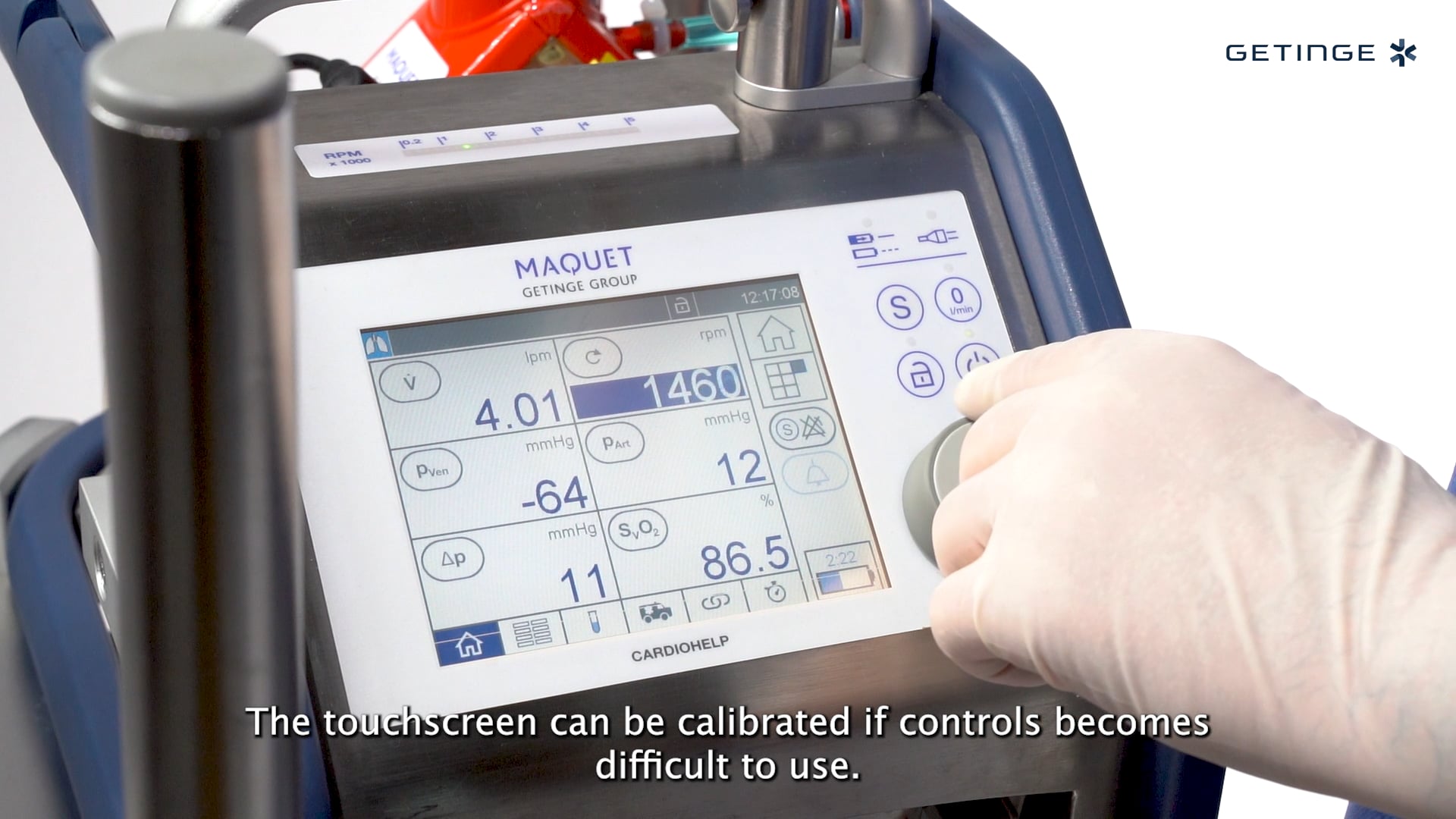 CARDIOHELP: Screen Calibration on Vimeo