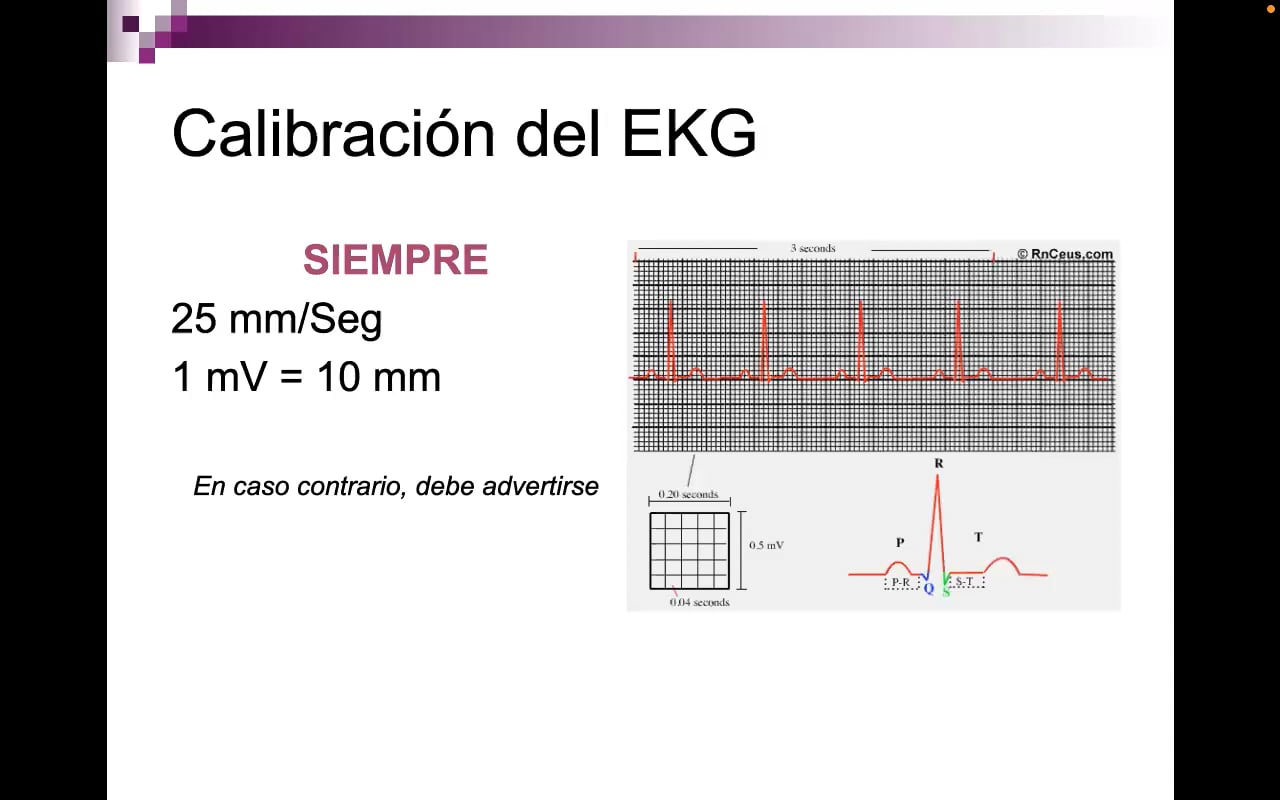 EKG.mp4 on Vimeo