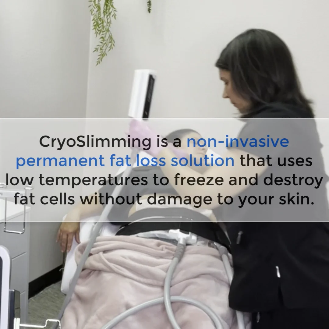 CryoSlimming & CryoLean on Vimeo