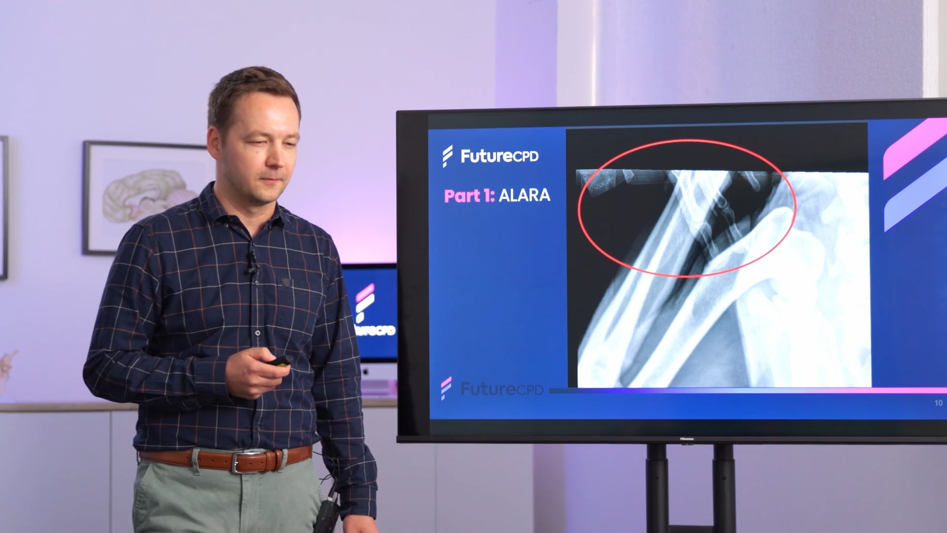 Principals of Thoracic Imaging - Dan Davies Preview on Vimeo