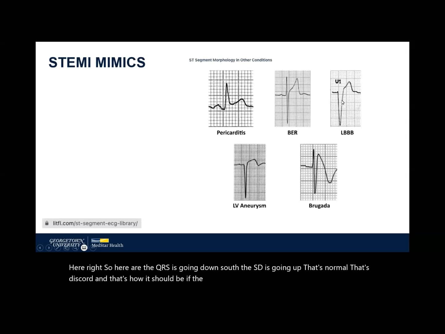 Weissman - ACS for the ICU on Vimeo