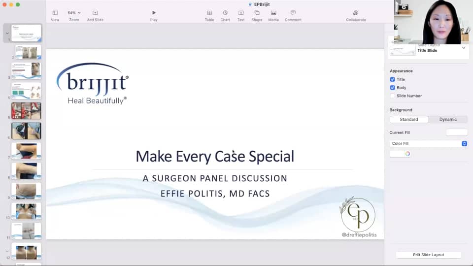 Make Every Case Special with Brijjit.mp4 on Vimeo