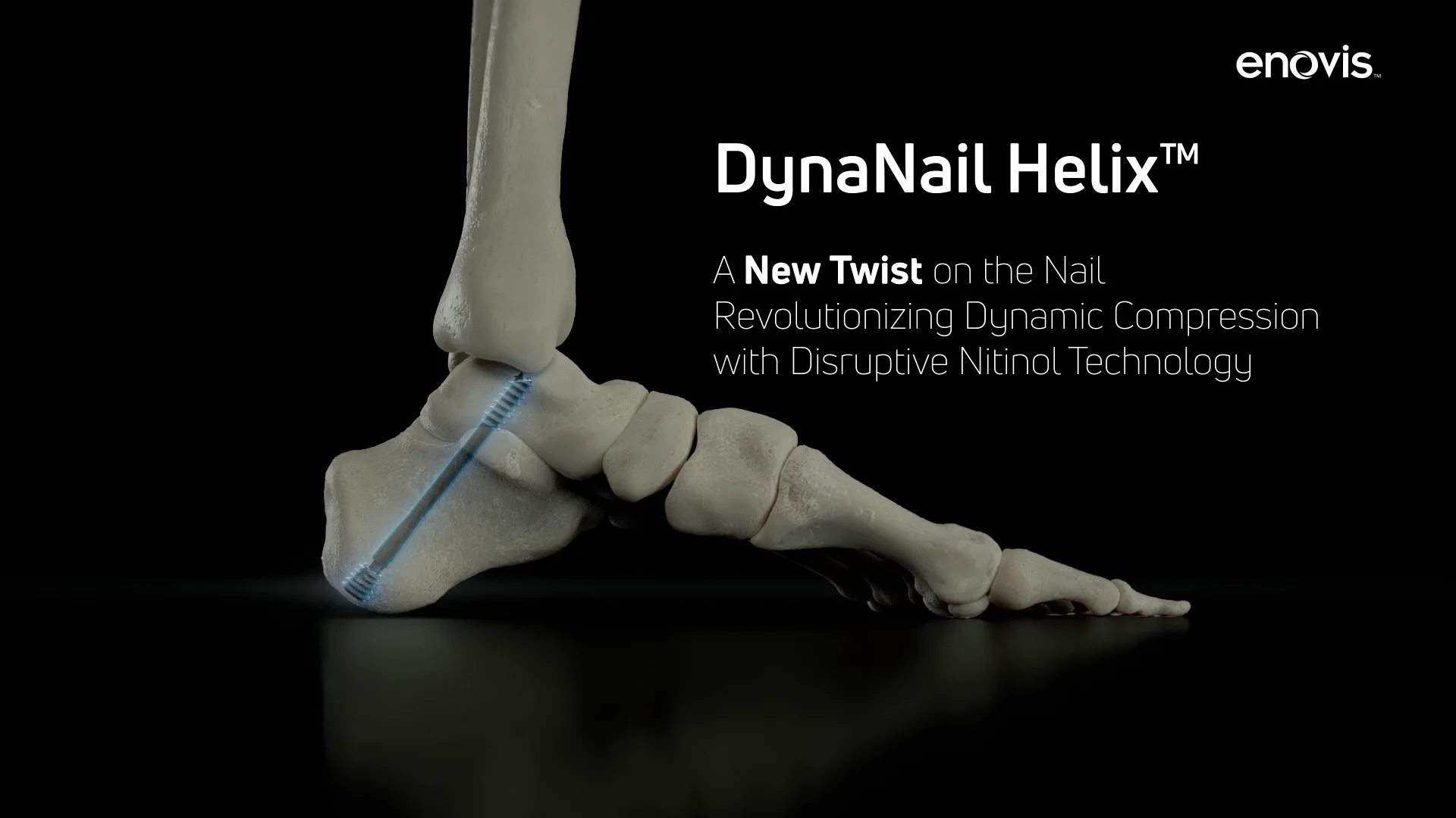 DynaNail Helix Animation on Vimeo