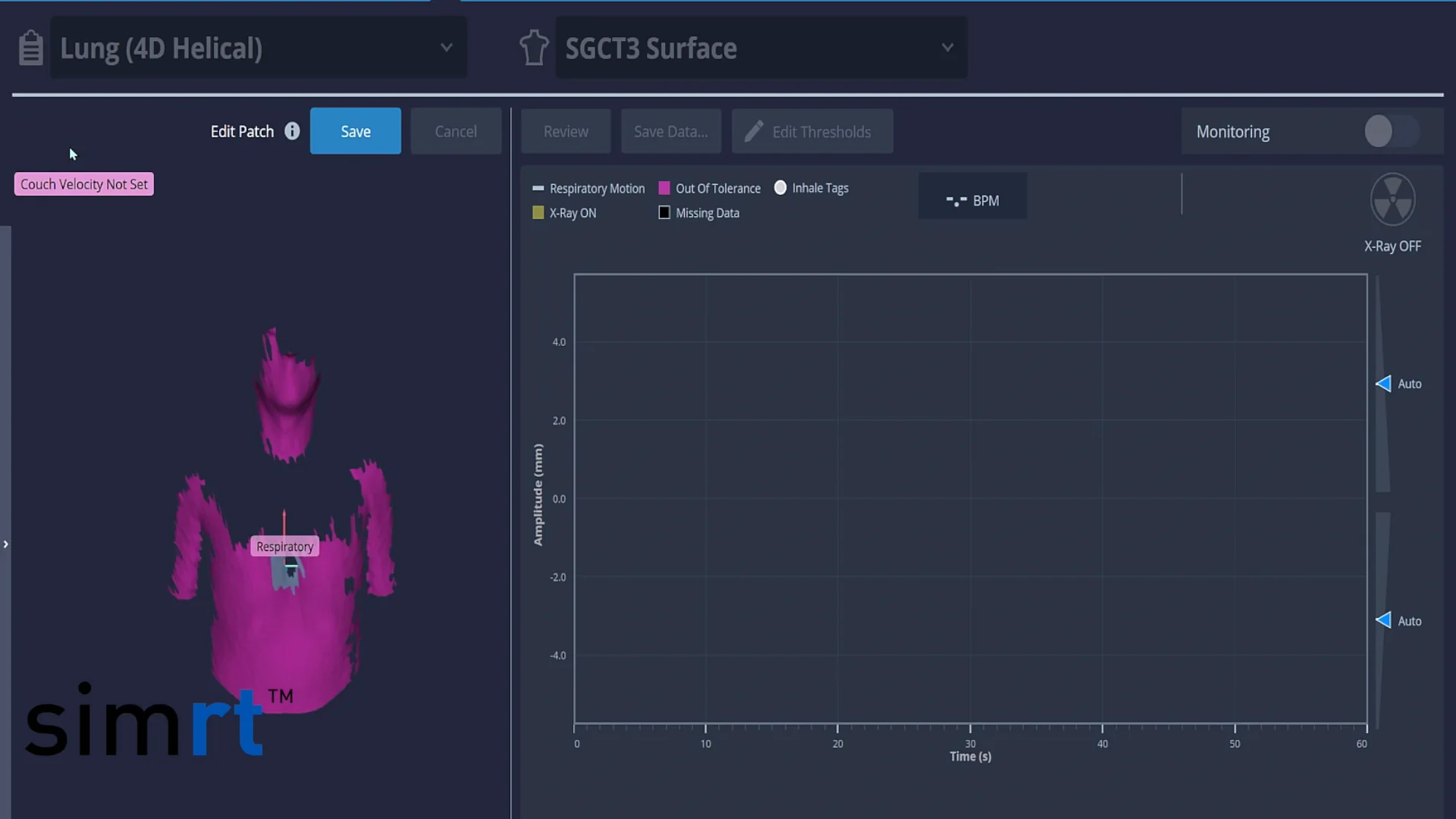 SimRT patch placement