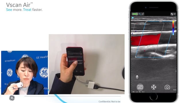 慢性腎臓病と腹膜透析、そして私たちの取り組み Part2 | Clinical Cloud by MEDIPAL