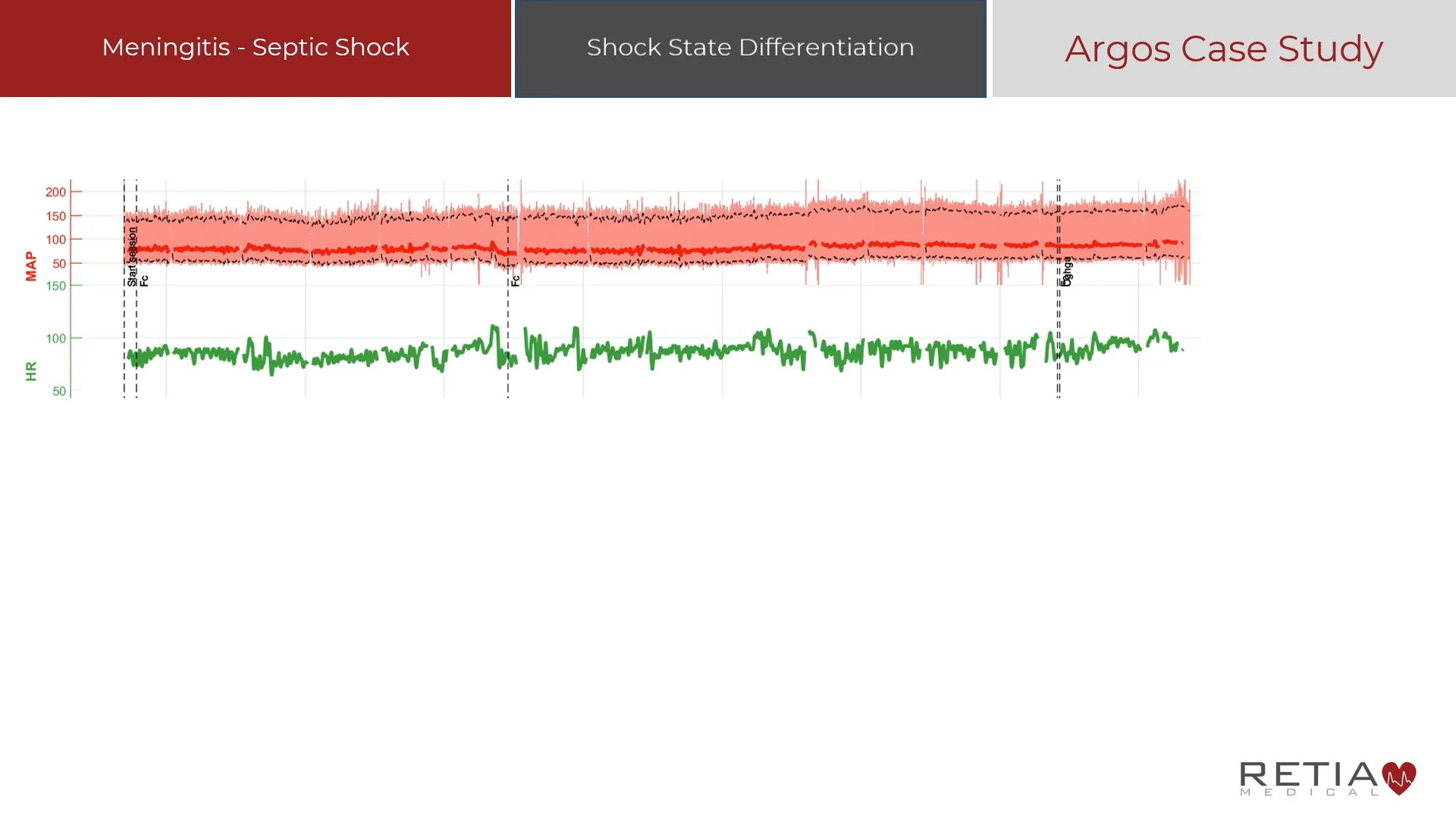Argos Case Study Sepsis (UTSW Neuro).mp4 on Vimeo