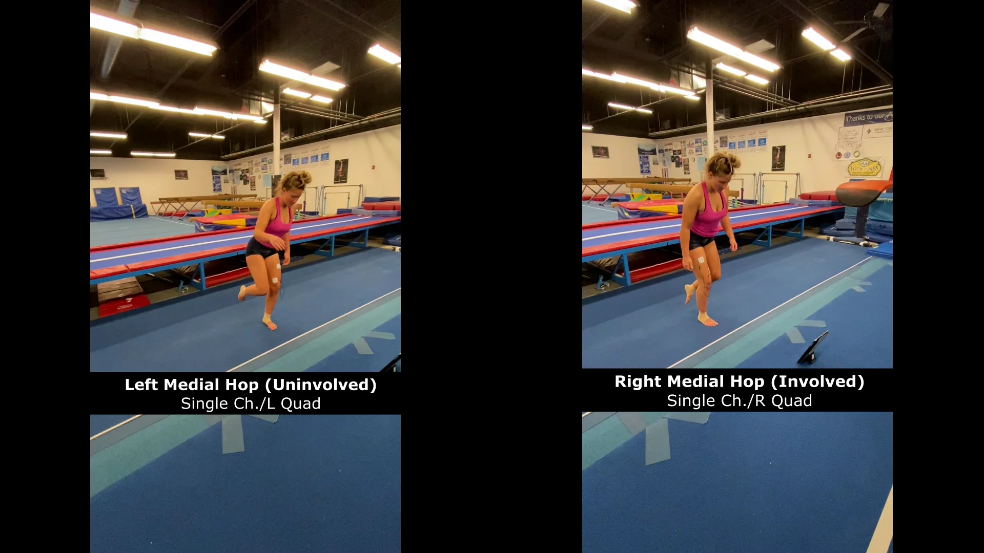 Medial Hop Comparison.mp4 on Vimeo