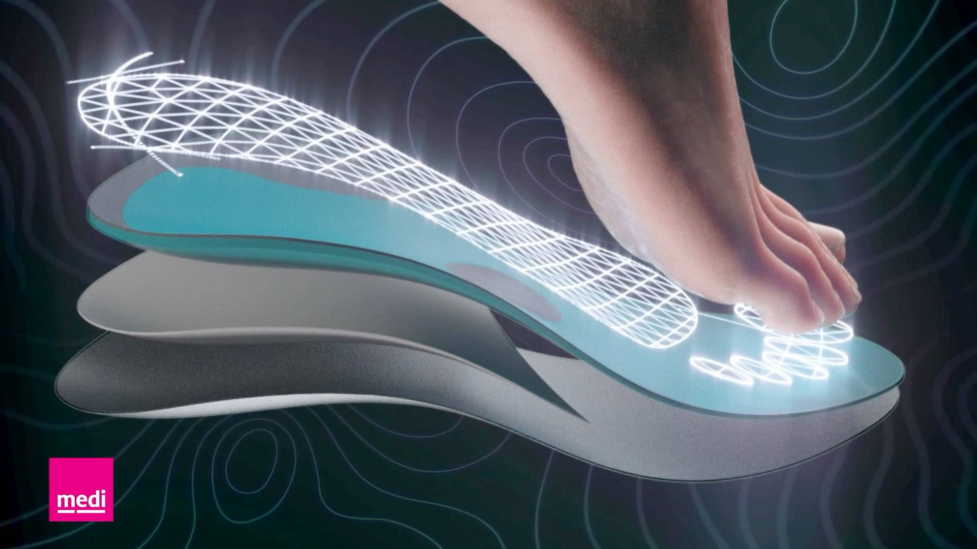 medi CAD® Fusion Teaser on Vimeo