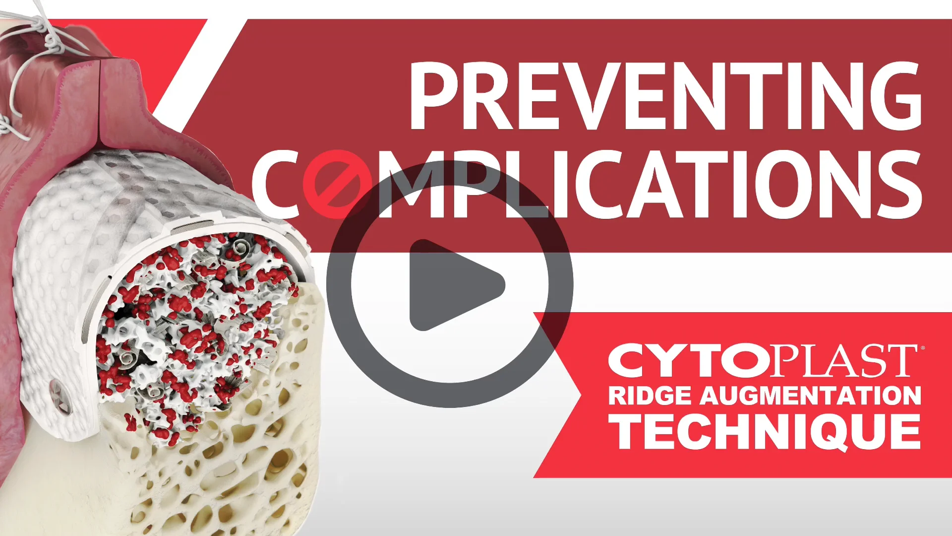 Preventing Complications 2