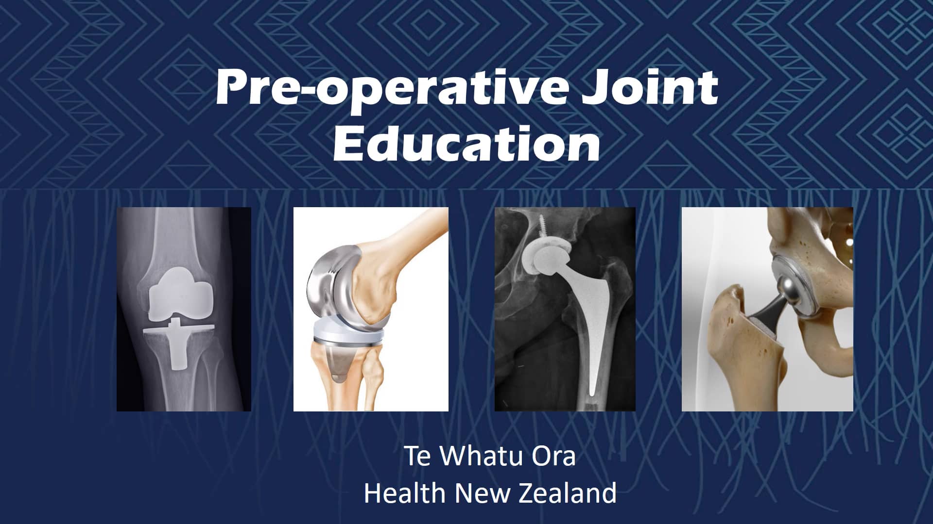 Pre-operative Joint Education on Vimeo