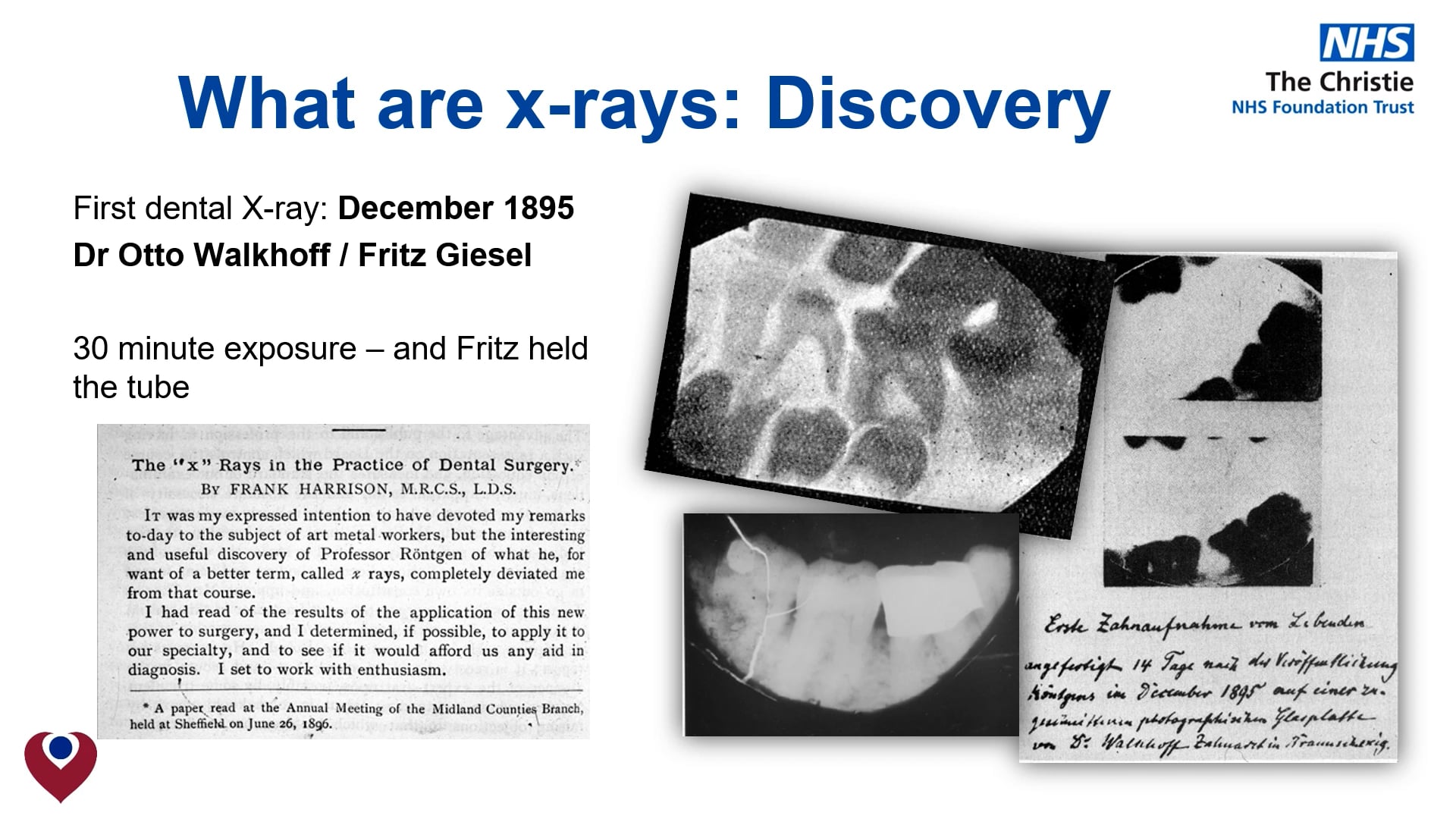 Dental lite bite 1. Introduction to IRR17 on Vimeo