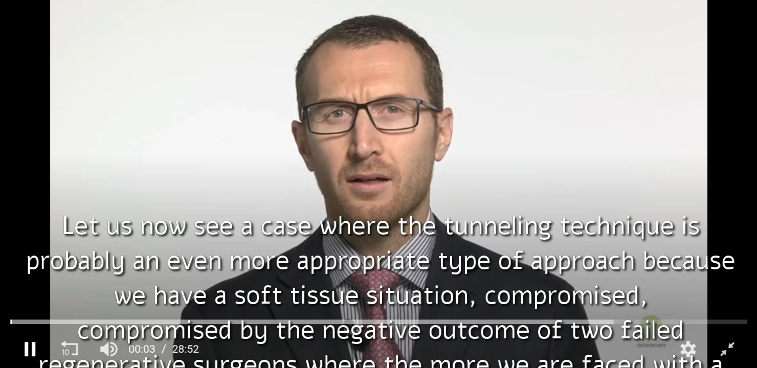 Tunnel Technique - Clinical Applications