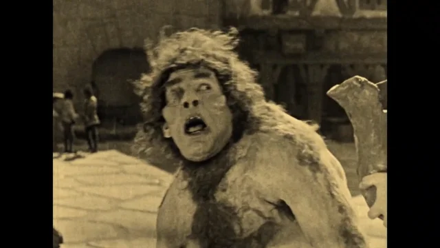 Real Hunchback People