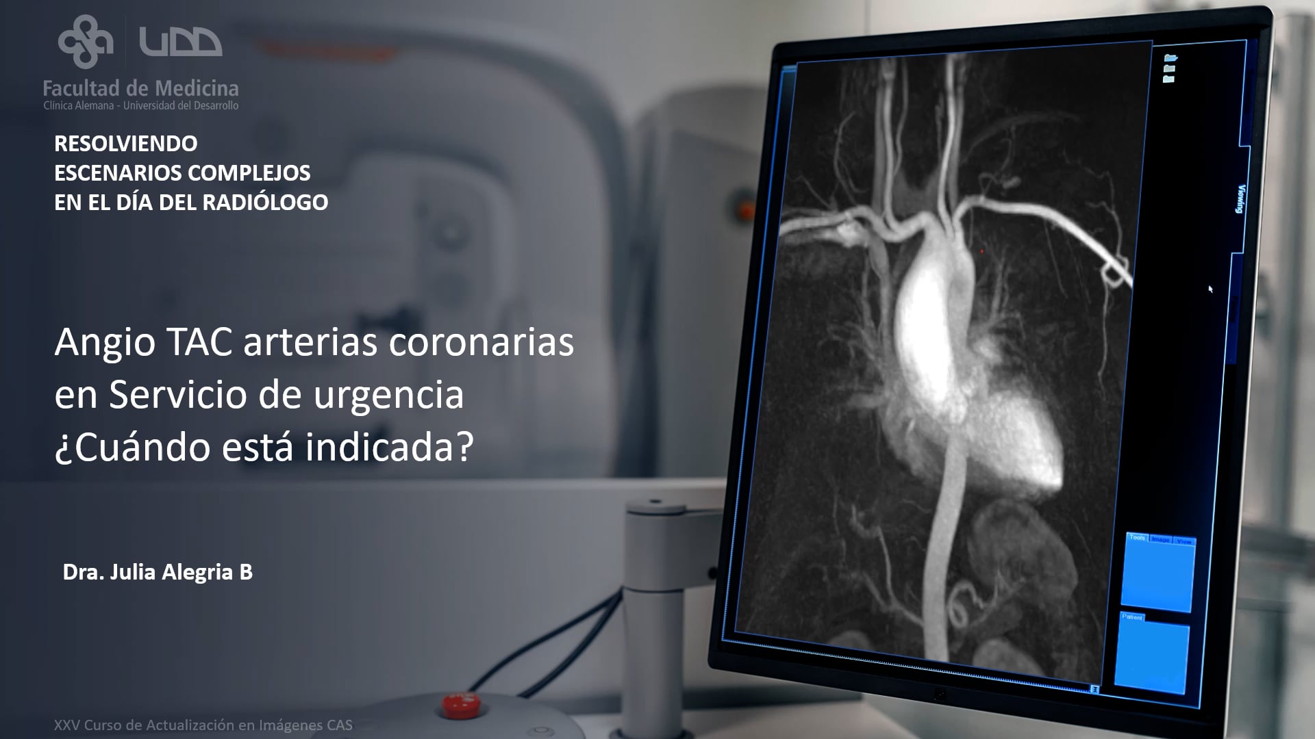 Angio TAC coronaria en servicio de urgencia , ¿cuándo está indicada ...
