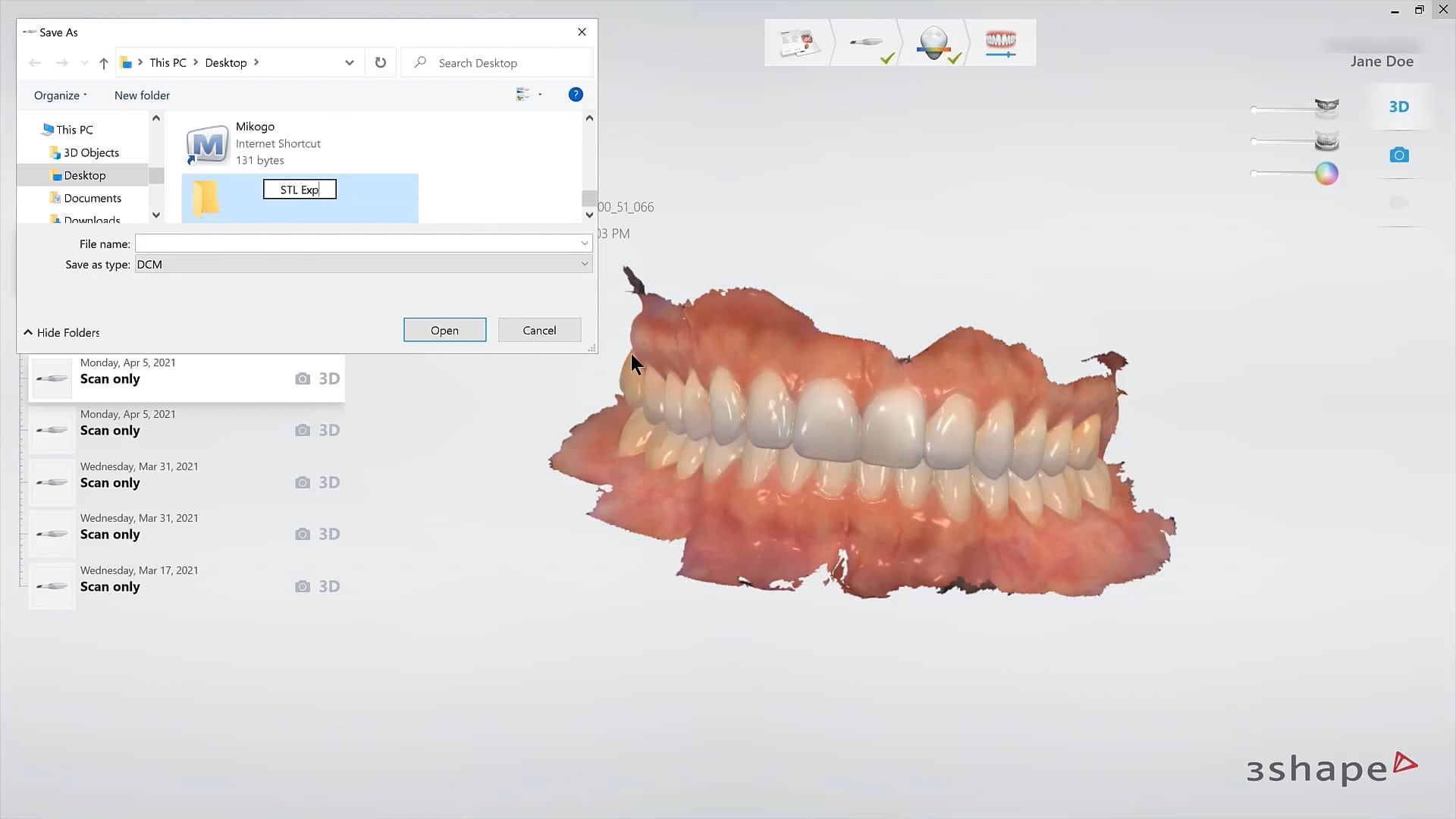 Exporting STL files from 3Shape TRIOS on Vimeo