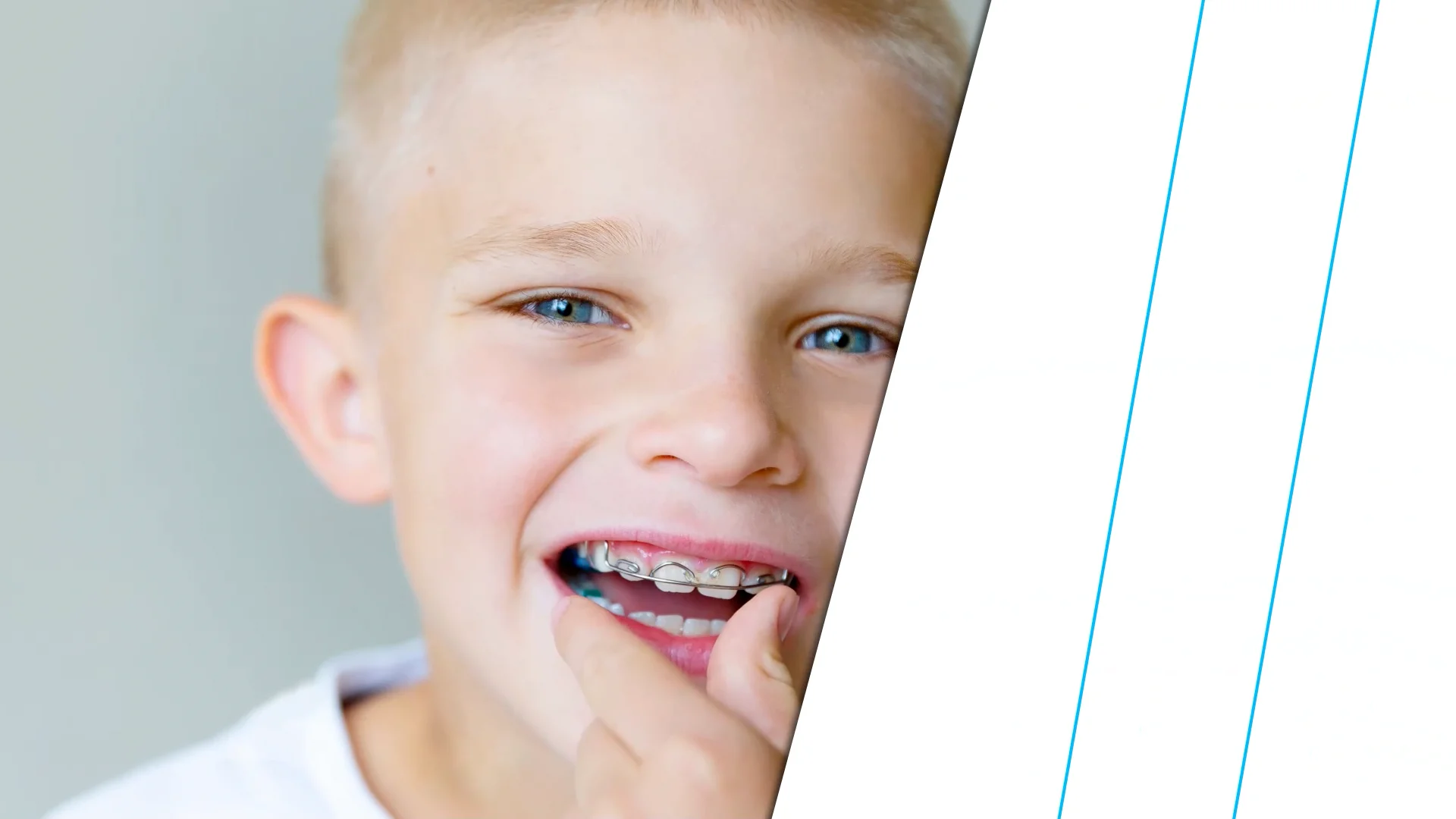 V3932 - Aparelhos infantis - Saúde Bucal on Vimeo