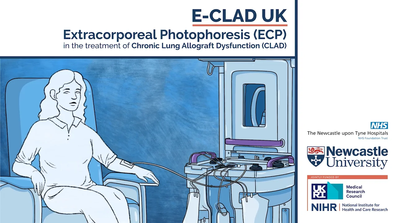 ECLAD-ECP Treatment on Vimeo