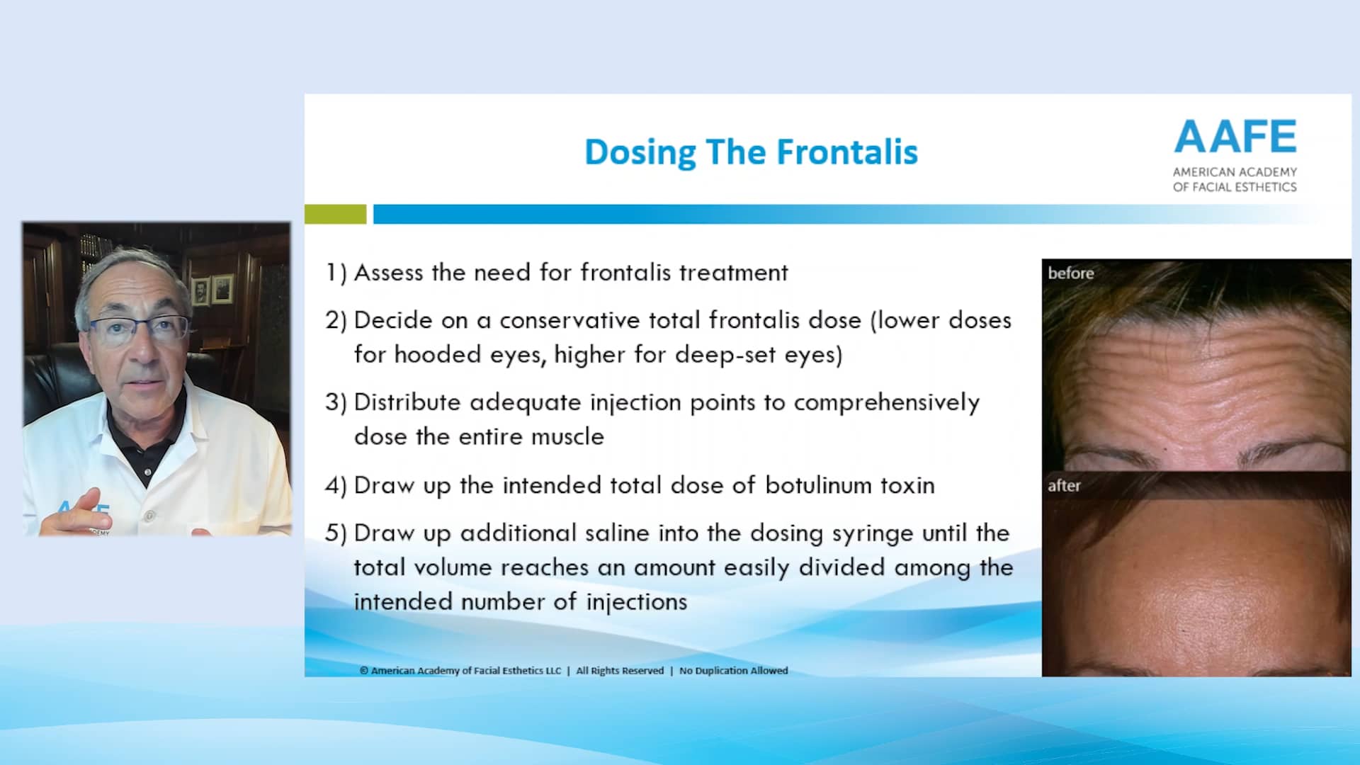 14 botox frontalis 2.mp4 on Vimeo