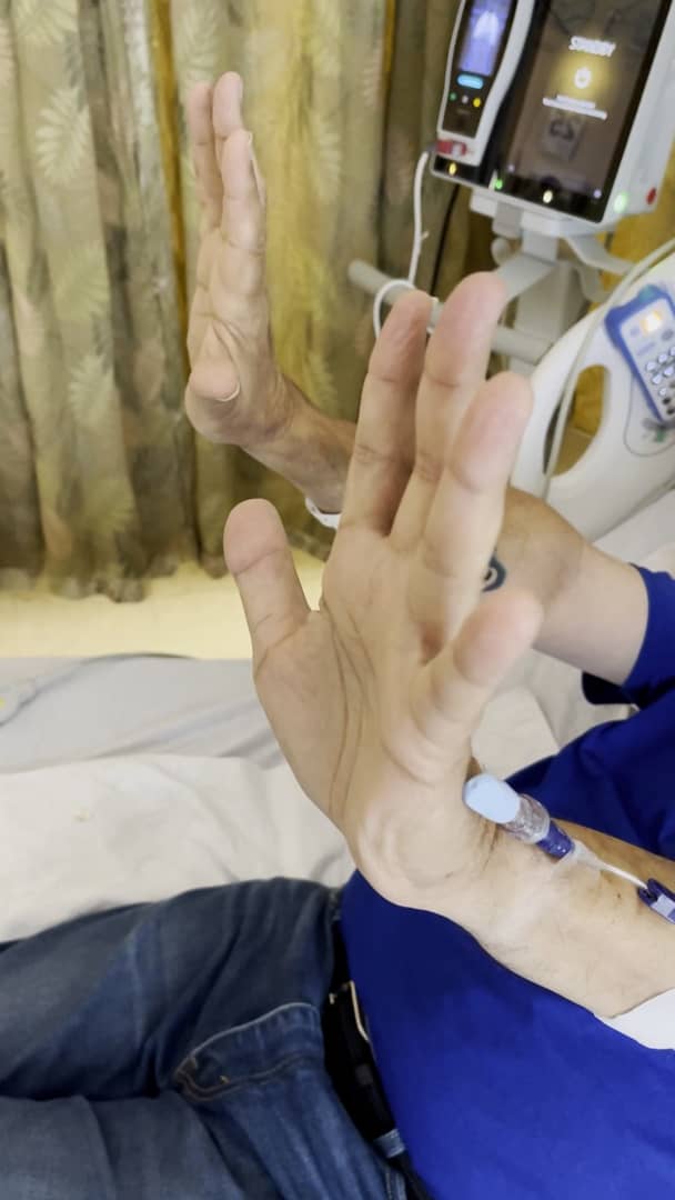 [2] Bilateral Asterixis Associated with Supratherapeutic Carbamazepine ...