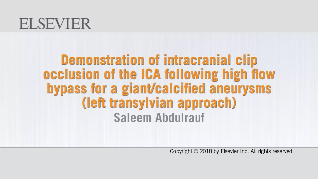 Video 6 Demonstration of intracranial clip occlusion of the ICA ...