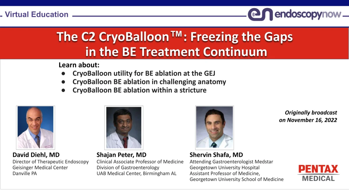 The C2 CryoBalloon™ Freezing the Gaps in the BE Treatment Continuum on Vimeo