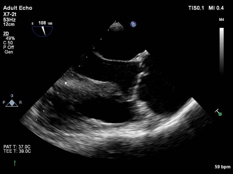 ME_AV_LAX_VSR on Vimeo