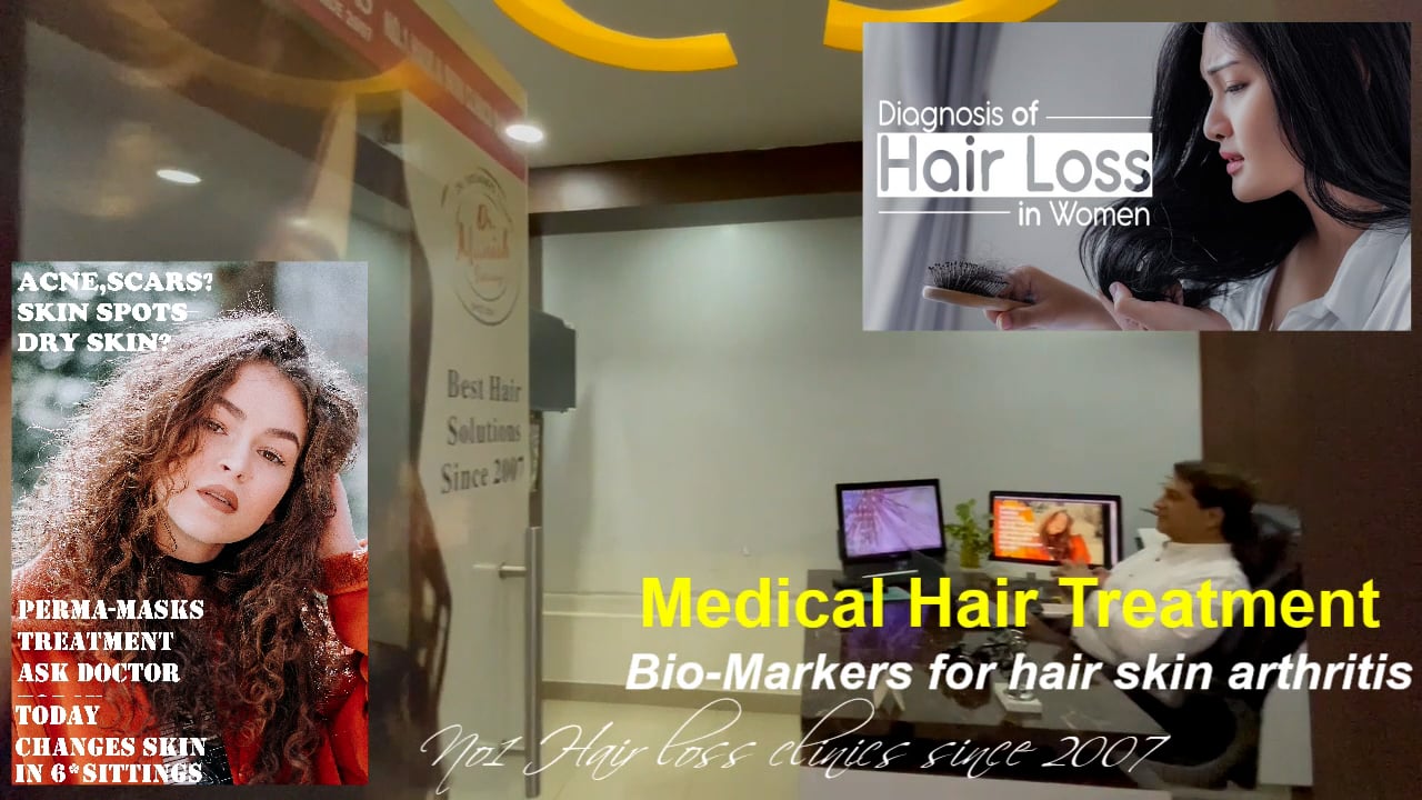 Hair Loss Treatment,Homeopathy for Alopecia Areata Baldness Leucoderma ...