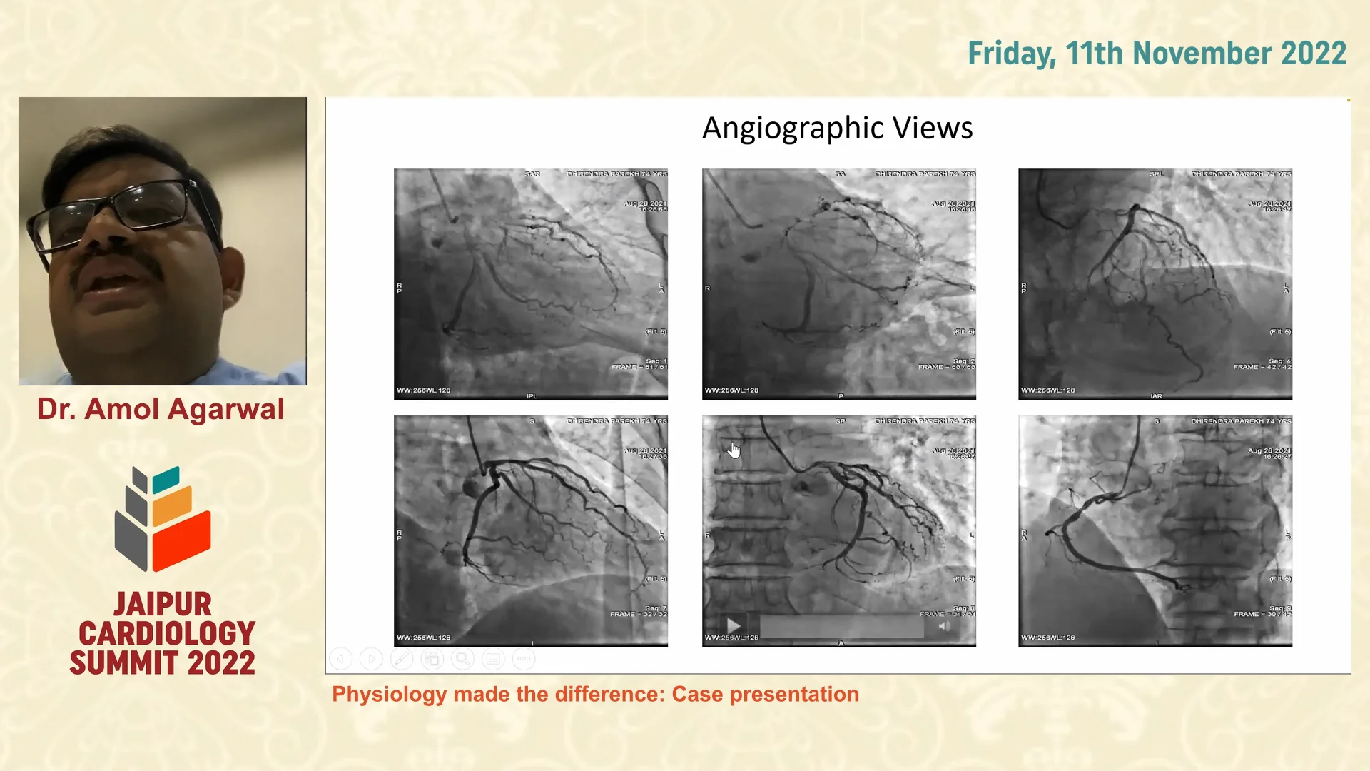 Talk_Day_1_Dr. Amol Aggarwal on Vimeo