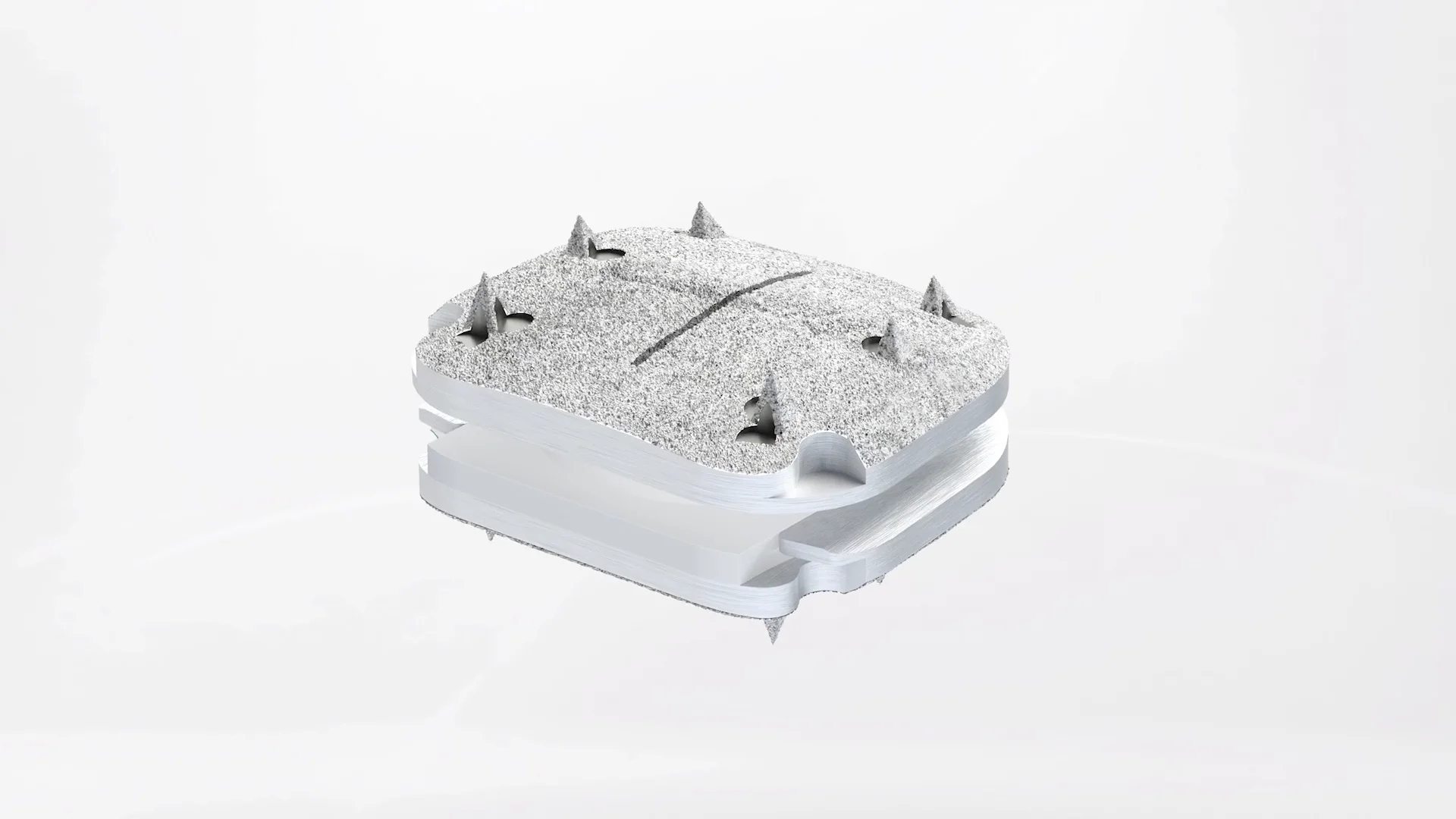 Centinel Spine Videos - prodisc C Vivo Surgical Technique with prodisc ...