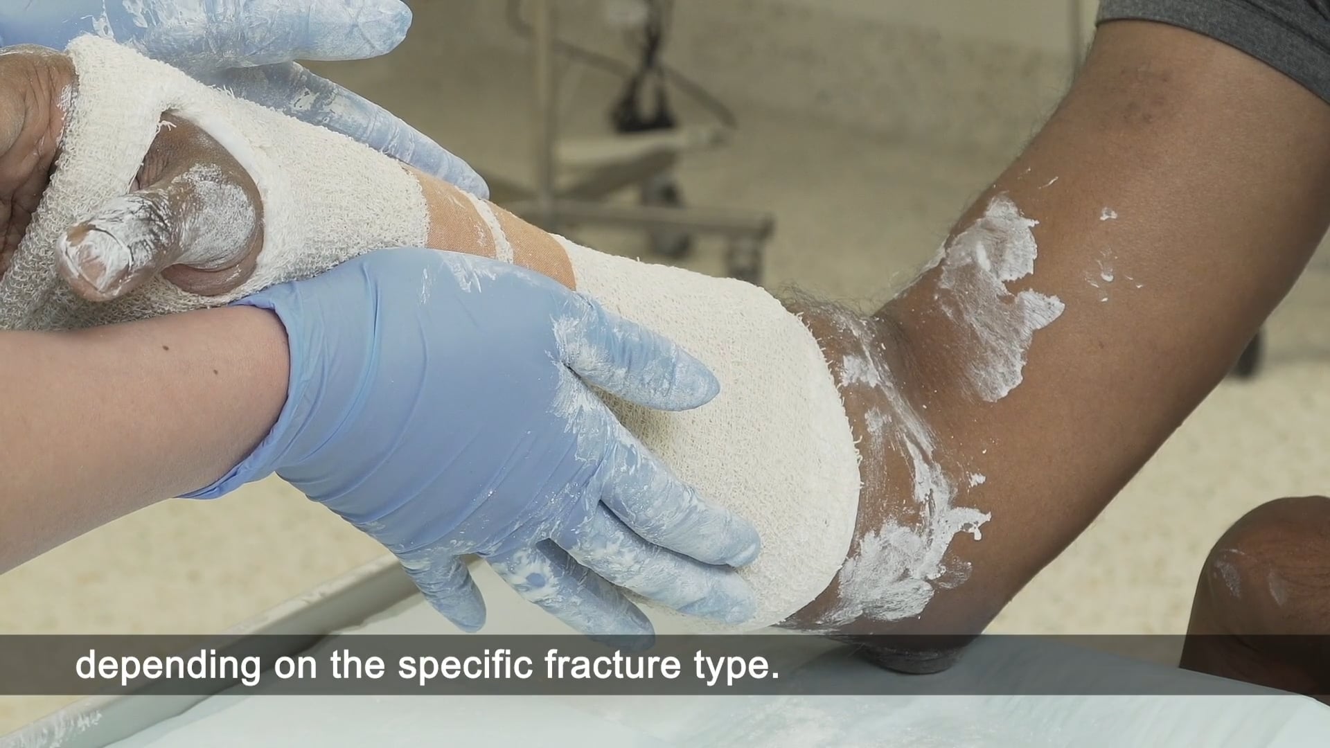 Volar Short Arm Slab.mp4 on Vimeo