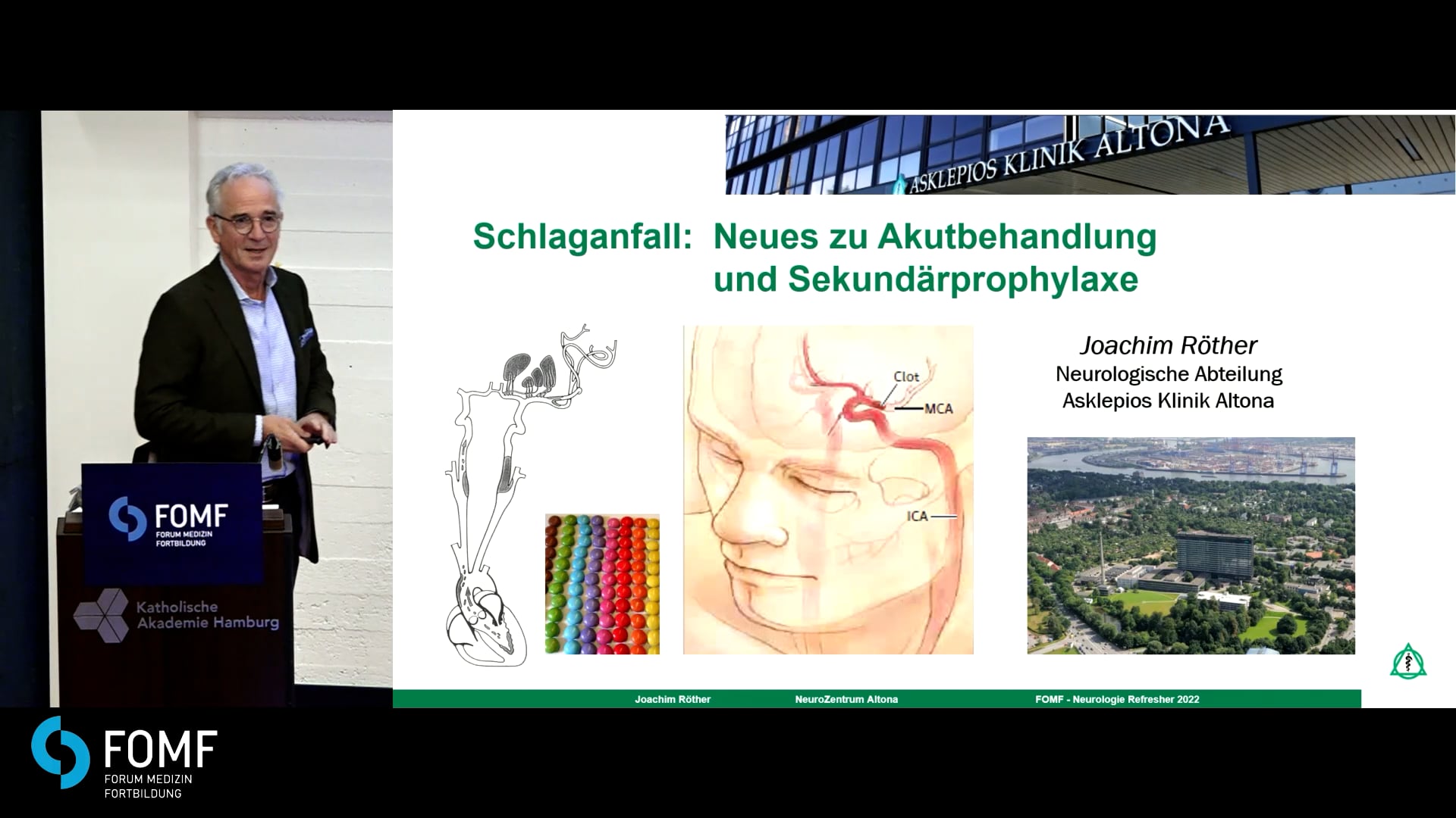 Schlaganfall: Neues zu Akutbehandlung und Sekundärprophylaxe | CME ...
