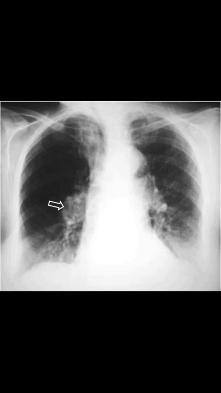 SIGNO DE WESTERMARK on Vimeo