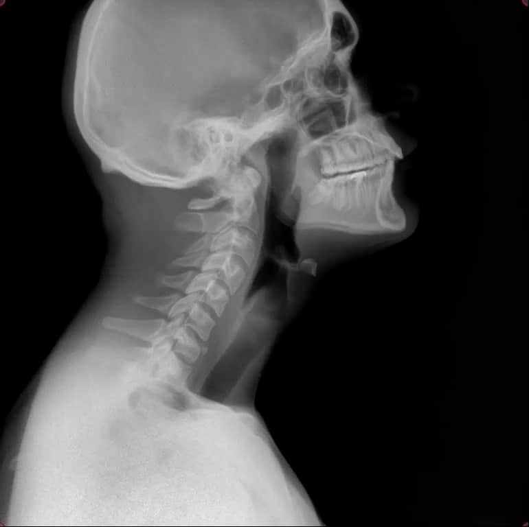 C-Spine Lat Flexion and Extension on Vimeo