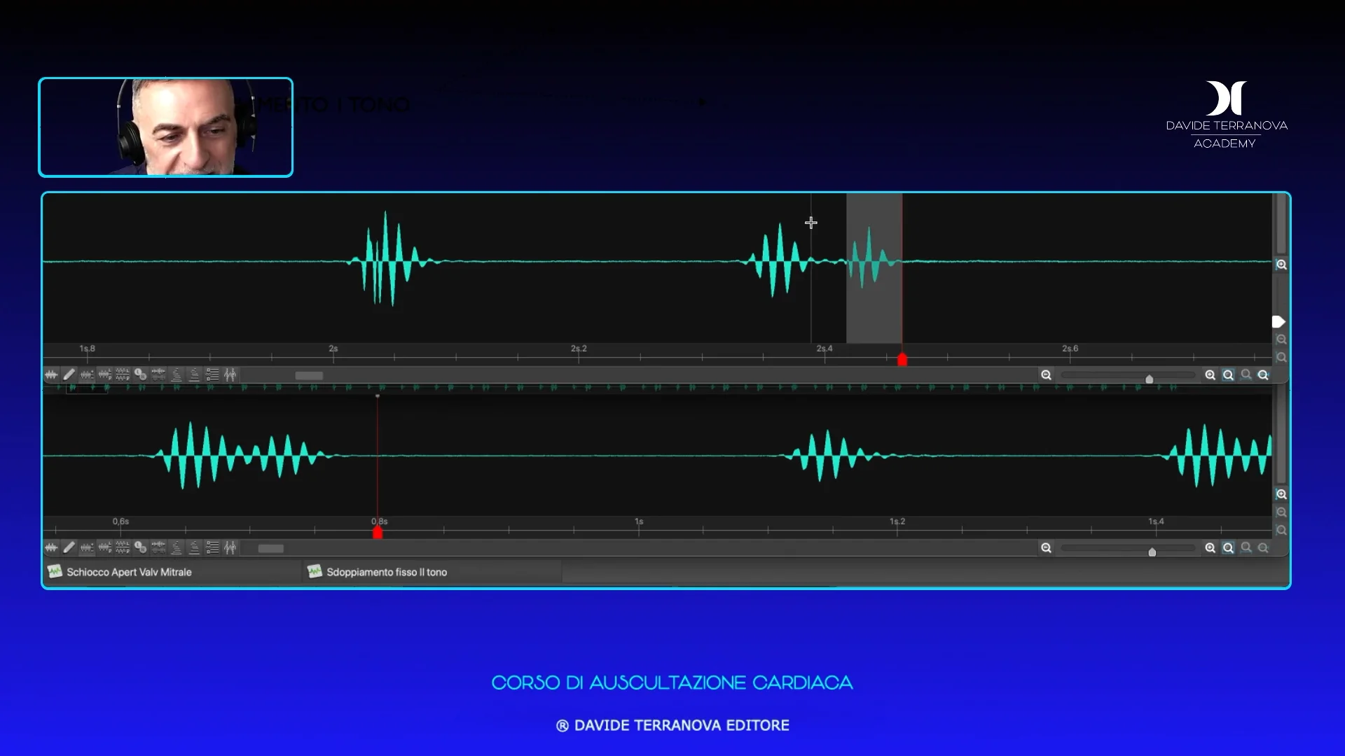 A_13_Clic Protodiastolico_DDifferenziale on Vimeo