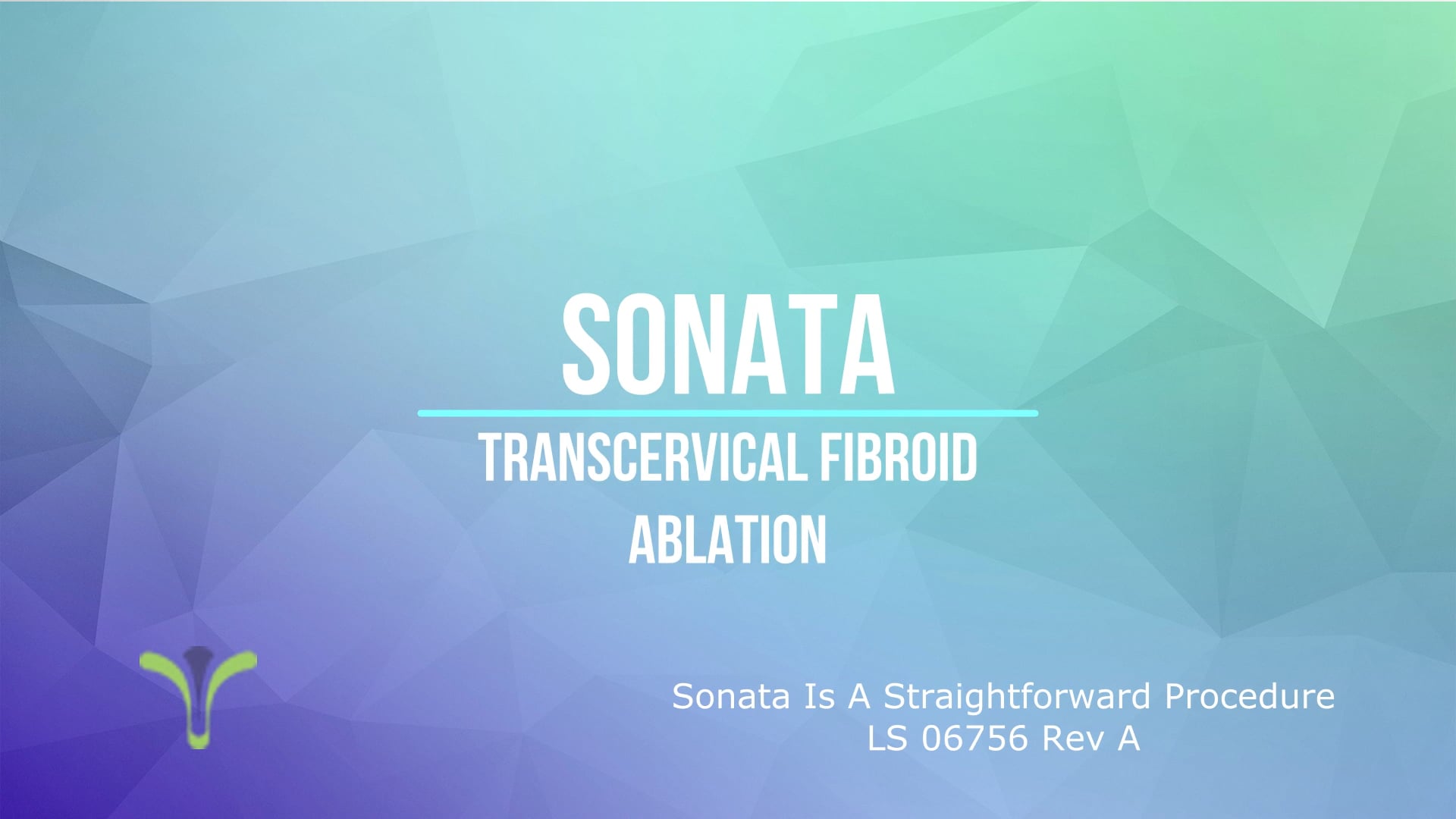 Single Ablation of Uterine Fibroid: A Straightforward Procedure with ...