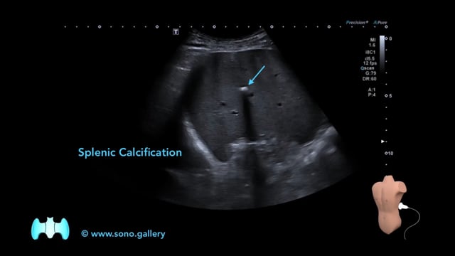 Spleen Archives - SONO.GALLERY