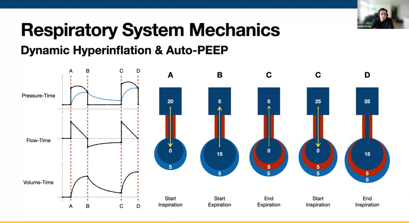 Oweis- Mechanical Ventilation in Obstructive Lung Disease on Vimeo