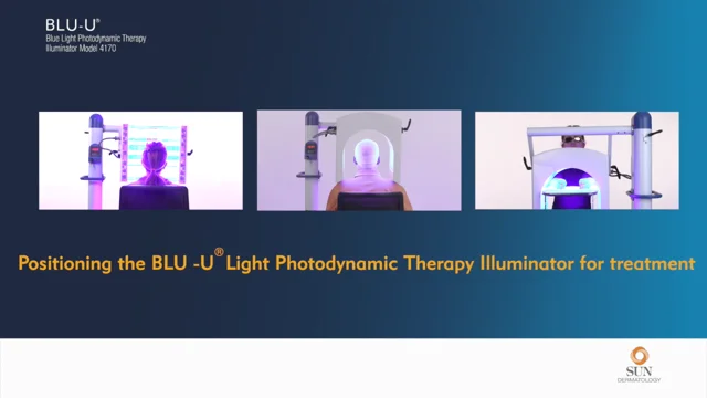 Blu U Blue Light Photodynamic Therapy Illuminator Model 4170 | Shelly ...