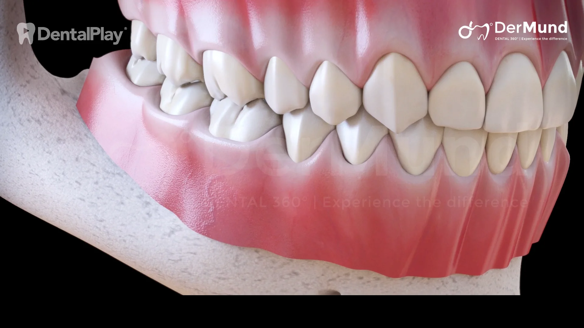 15 Cavities and the Influence of Tooth Decay on Health on Vimeo